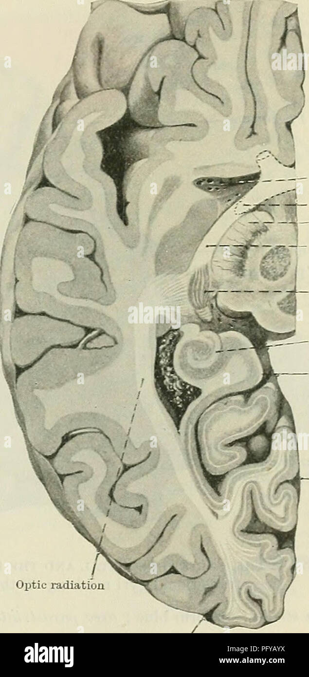 . Cunningham's Text-book de l'anatomie. L'anatomie. CORP. GEN. MED.. yj ...