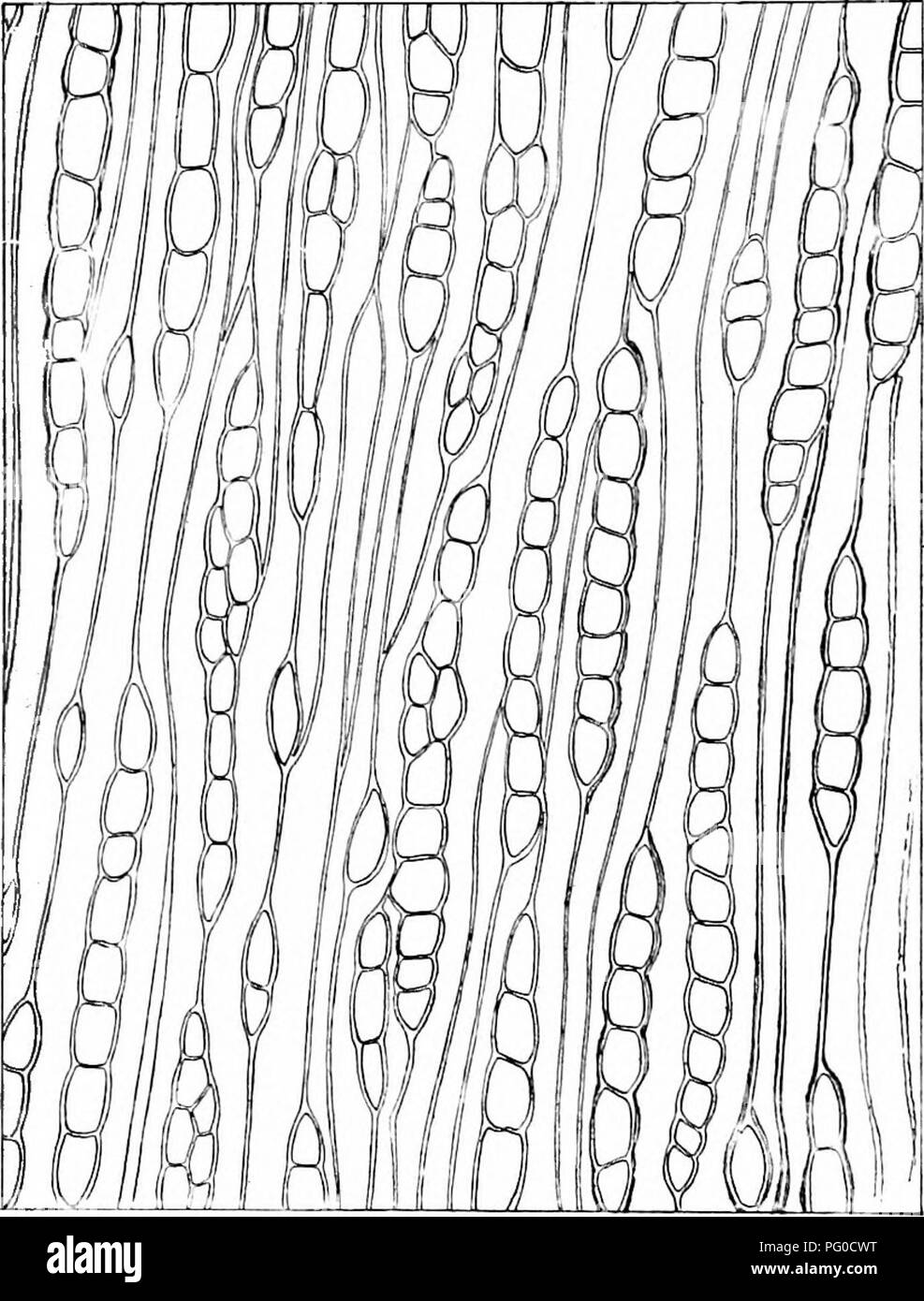 Trachéides scalariformes Banque d'images noir et blanc - Alamy