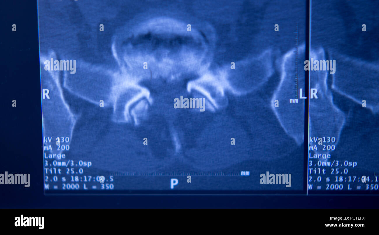 X-ray hôpital médical rachis bassin hanches traumatologie IRM scan ...