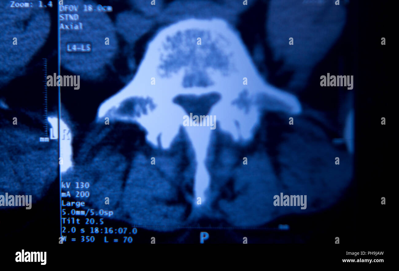X-ray hôpital médical rachis bassin hanches traumatologie IRM scan ...