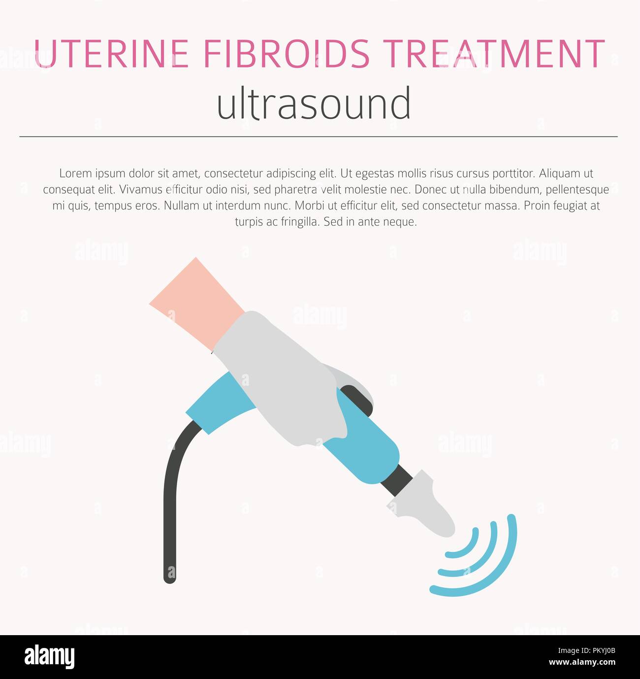 Les fibromes utérins. Ginecological maladie médicale chez les femmes ...
