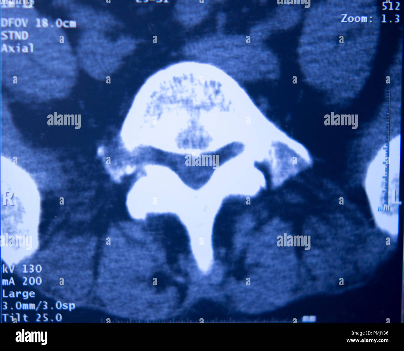 X-ray hôpital médical rachis bassin hanches traumatologie IRM scan ...
