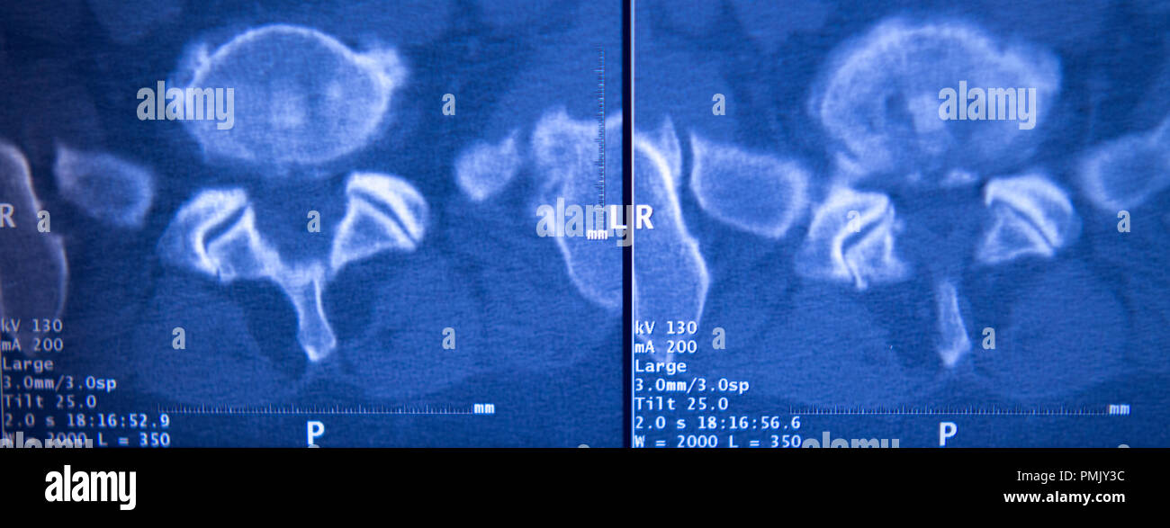 X-ray hôpital médical rachis bassin hanches traumatologie IRM scan ...