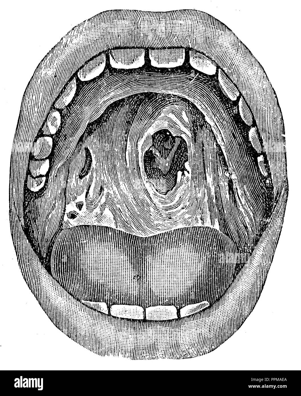 Palais dur Banque de photographies et d’images à haute résolution - Alamy