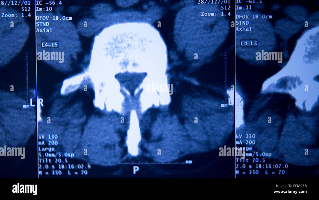 X-ray hôpital médical rachis bassin hanches traumatologie IRM scan ...