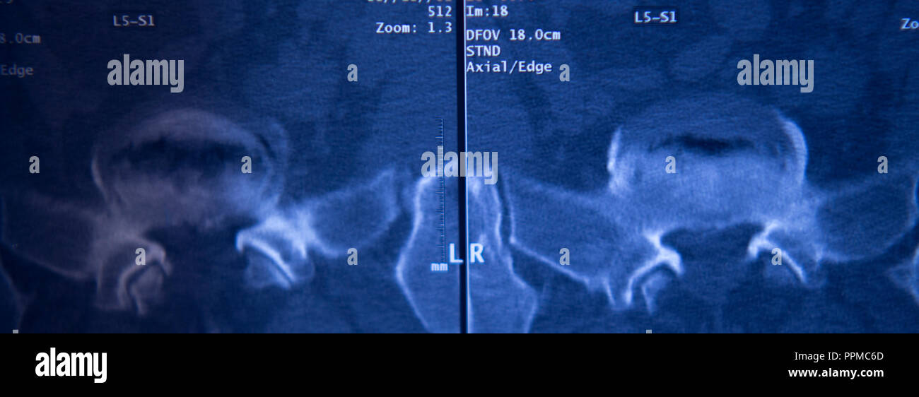 X-ray hôpital médical rachis bassin hanches traumatologie IRM scan ...