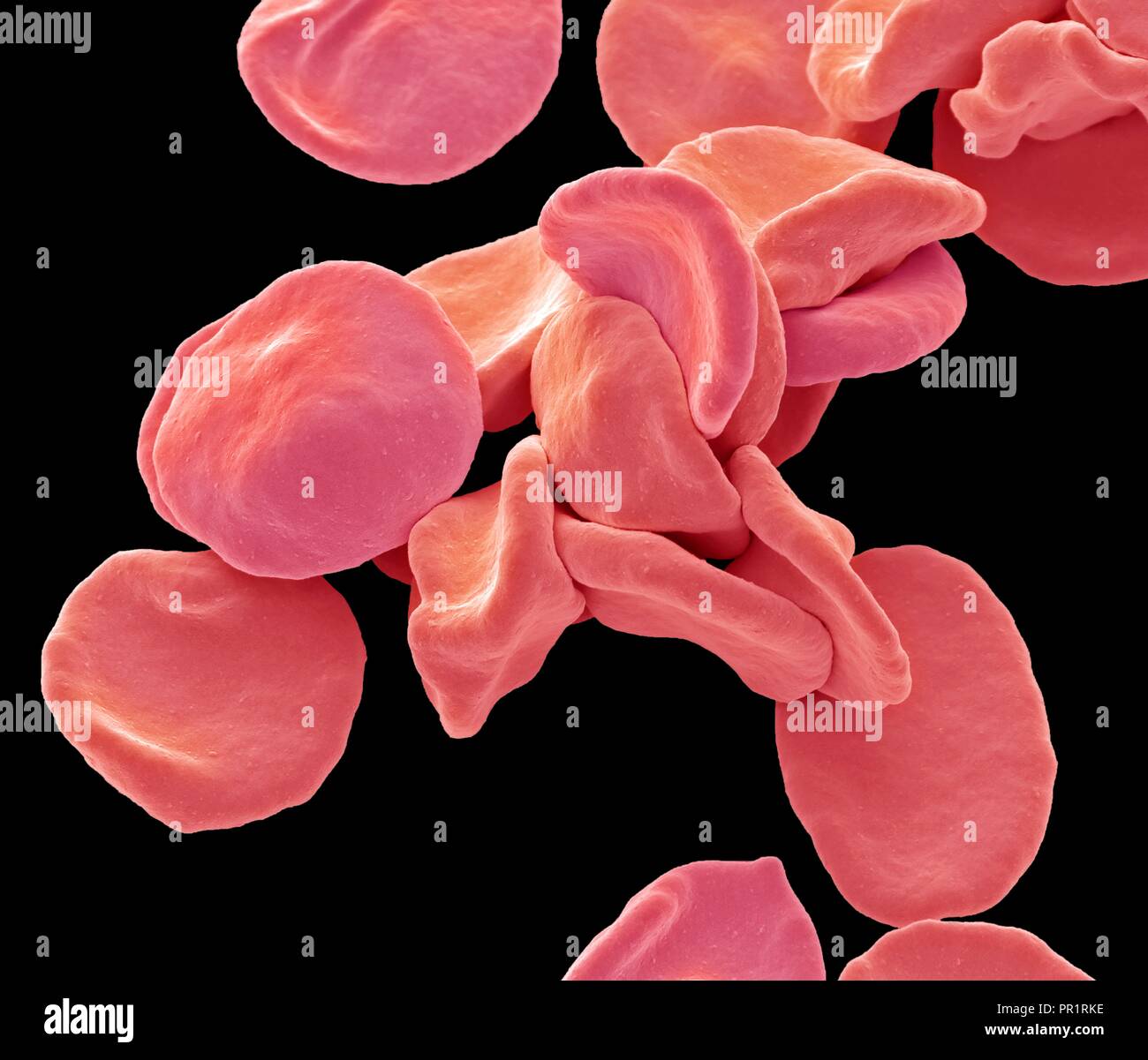 Couleur de l'analyse des électrons Microphotographie (SEM) de globules ...