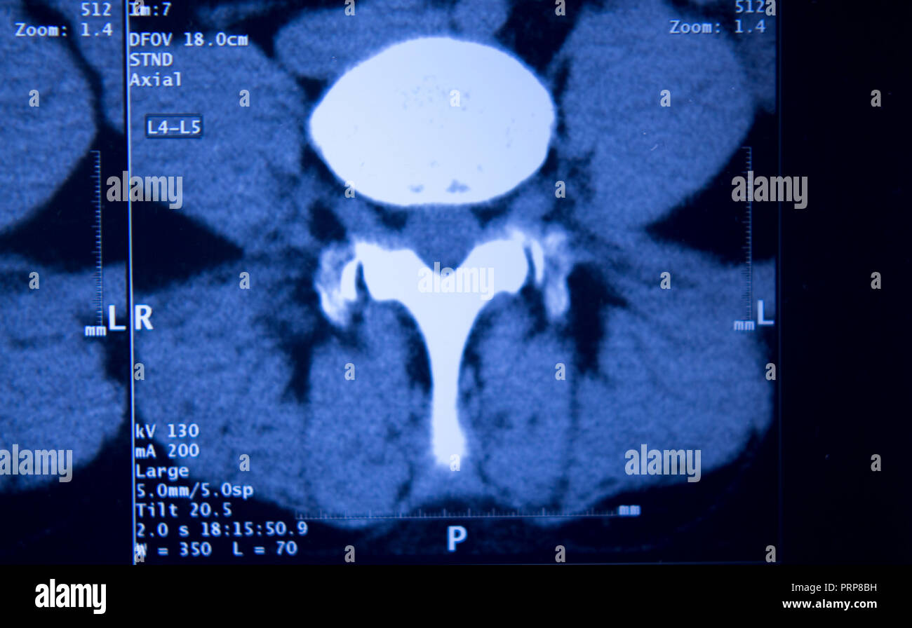 X-ray hôpital médical rachis bassin hanches traumatologie IRM scan ...