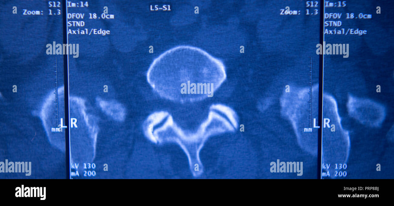 X-ray hôpital médical rachis bassin hanches traumatologie IRM scan ...