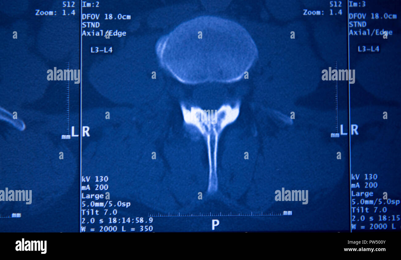 X-ray hôpital médical rachis bassin hanches traumatologie IRM scan ...