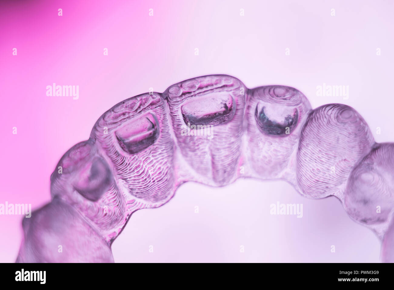 Dents dentaire invisible aligners crochets utilisés pour aligner chaque ...