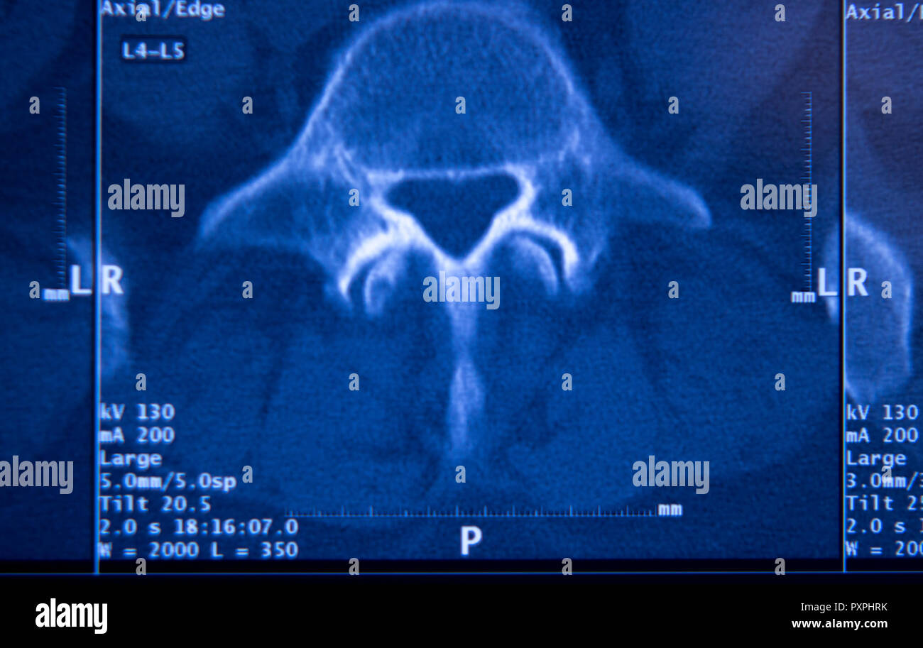 X-ray hôpital médical rachis bassin hanches traumatologie IRM scan ...