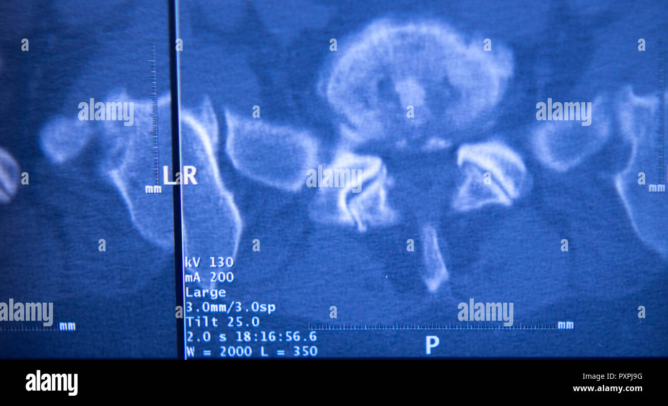 X-ray hôpital médical rachis bassin hanches traumatologie IRM scan ...