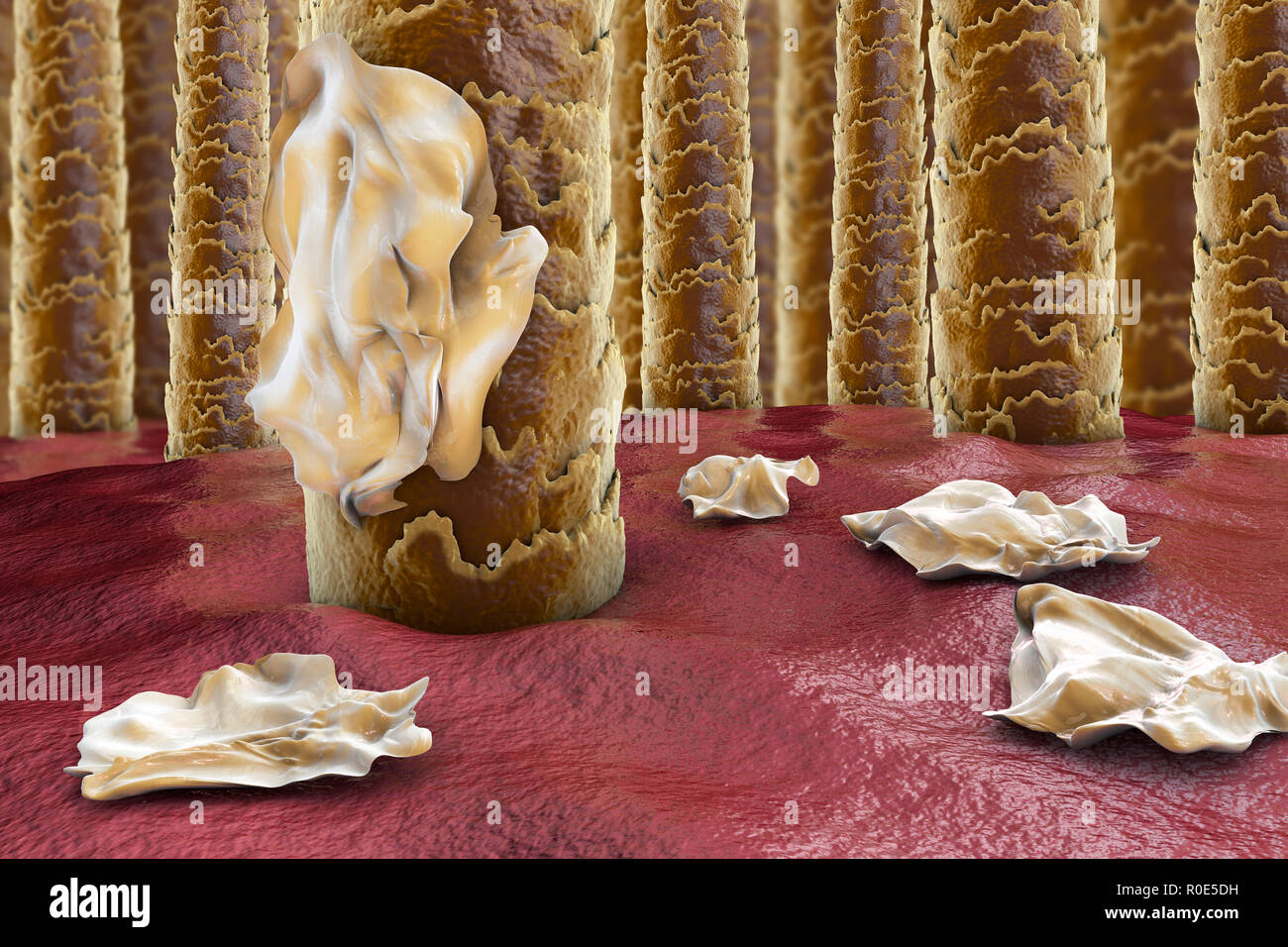 Pityriasis capitis Banque de photographies et d’images à haute ...