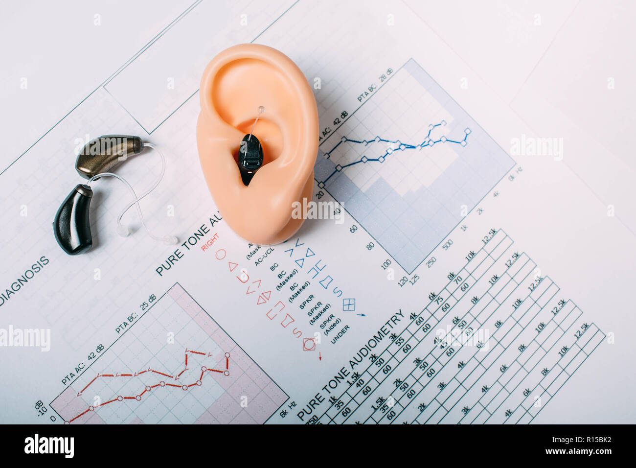 Test de concept. Suite de l'audition Examen - audiogramme, appareils ...