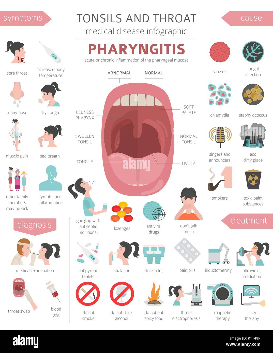 Amygdales et de la gorge. Les symptômes de la pharyngite, icône de ...