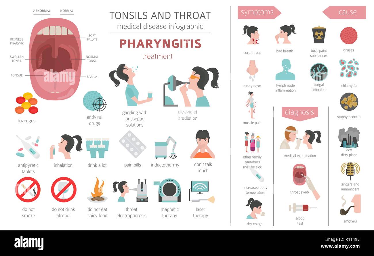 Amygdales et de la gorge. Les symptômes de la pharyngite, icône de ...