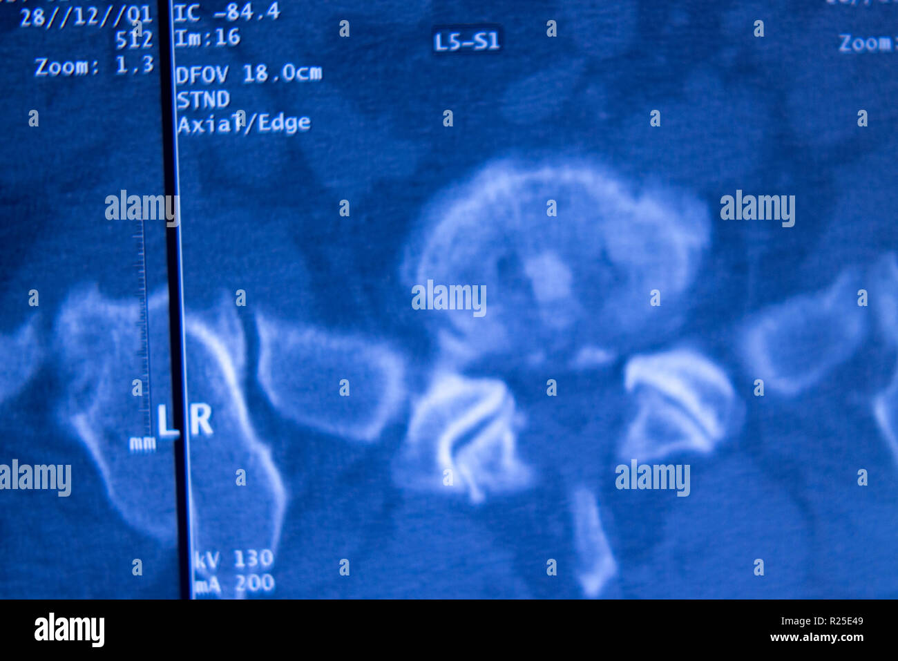 X-ray hôpital médical rachis bassin hanches traumatologie IRM scan ...