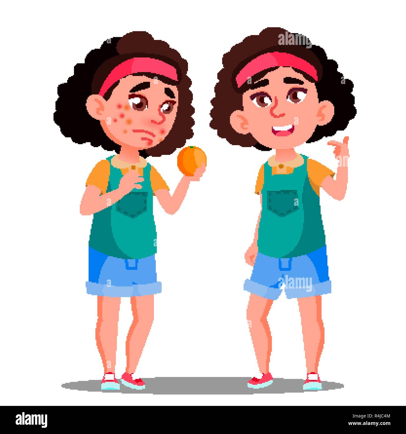 Réaction allergique, triste fille avec taches rouges tenant une orange ...