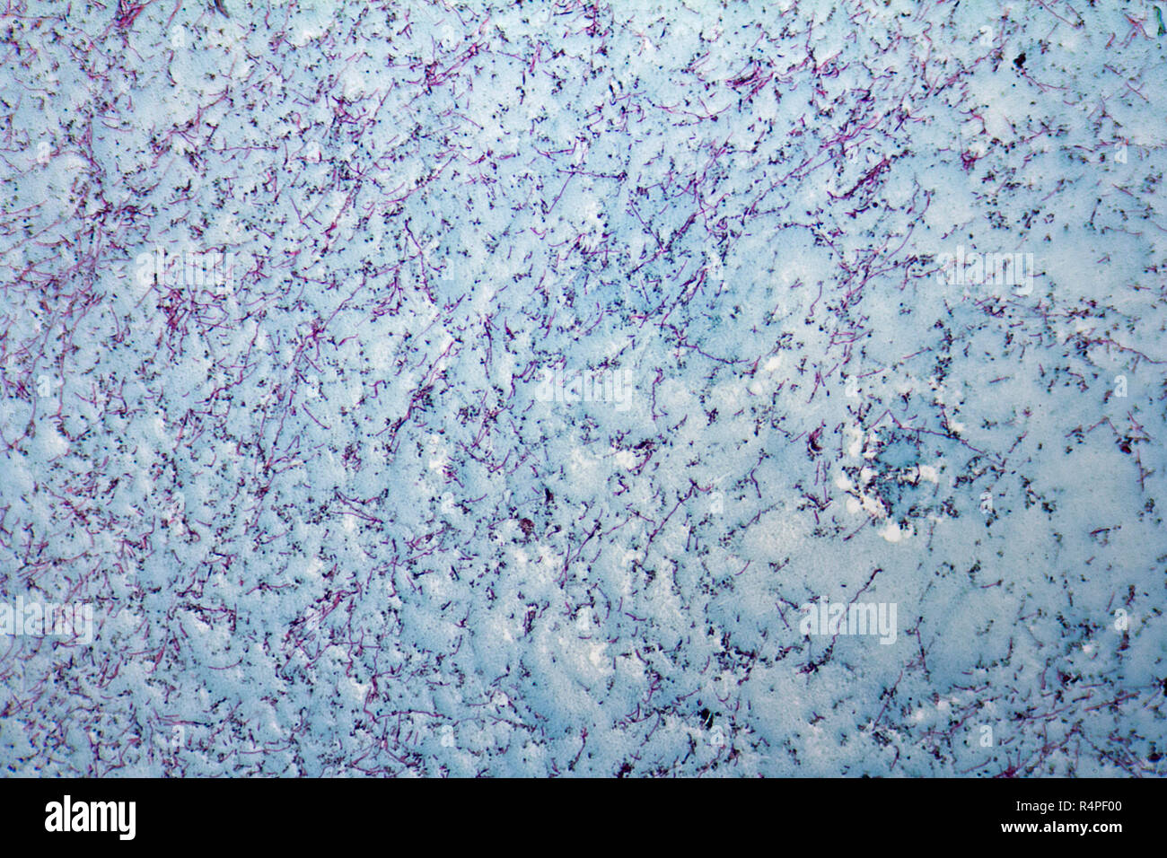 Cellule De La Vessie Banque d'image et photos - Alamy