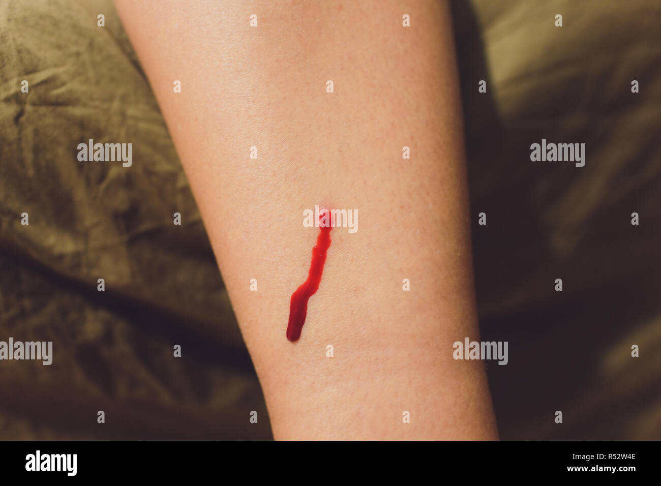 Une injection. Le traitement. Le sang humain. Maladie du sang. Donateur ...