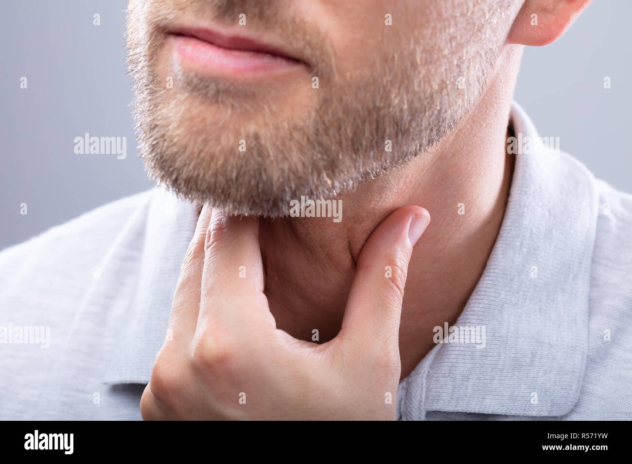 Cancer de la gorge Banque de photographies et d’images à haute ...