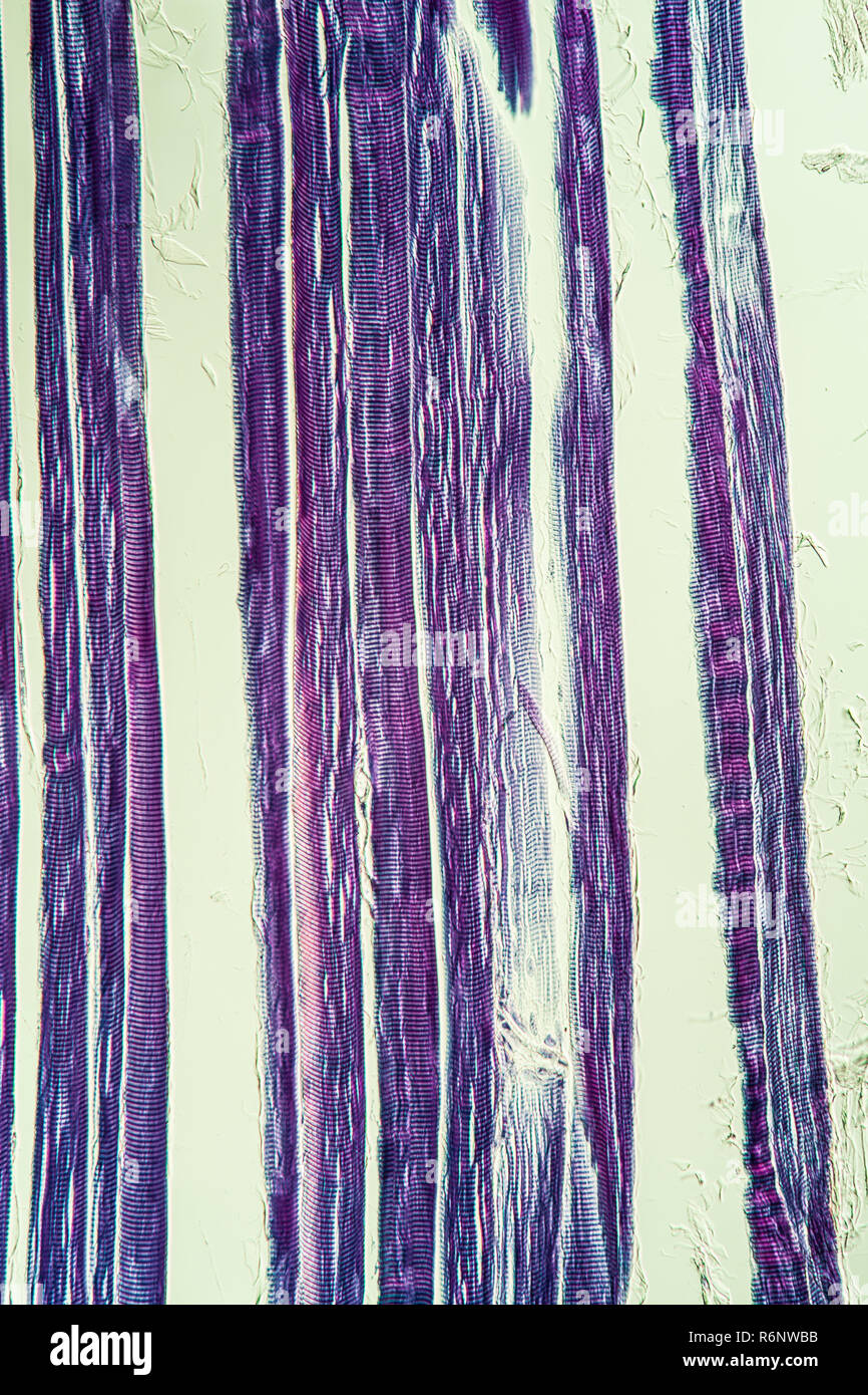 Tissu musculaire microscope Banque de photographies et d’images à haute ...