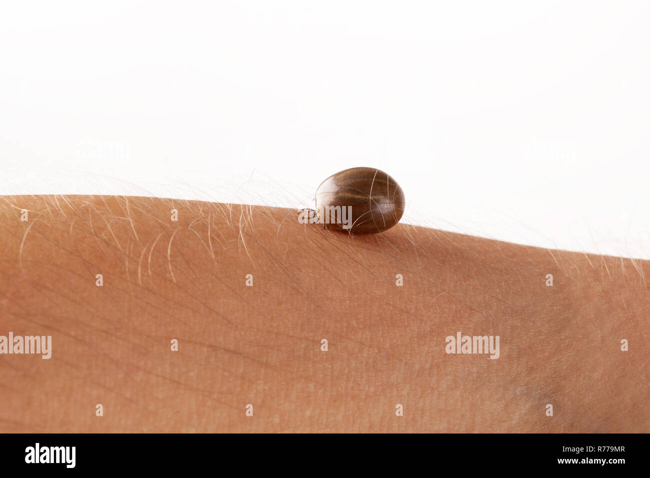 Morsure de tique sur le bras Banque de photographies et d’images à ...