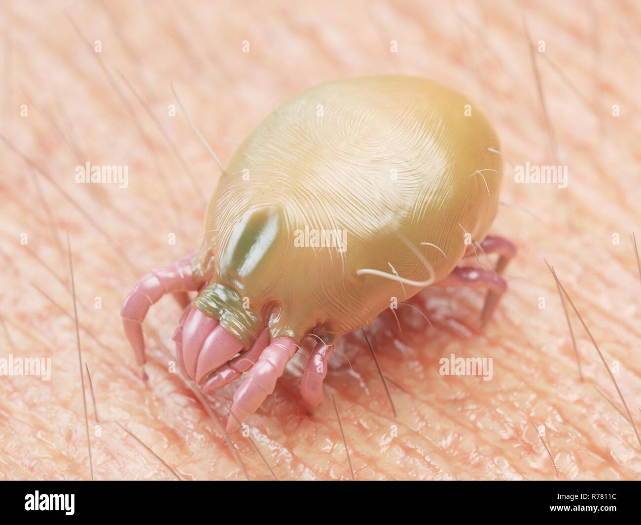 Allergie de la peau acarien Banque de photographies et d’images à haute ...