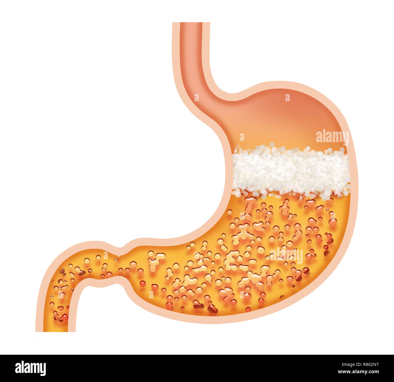 Poumon gastrique Banque de photographies et d’images à haute résolution - Alamy