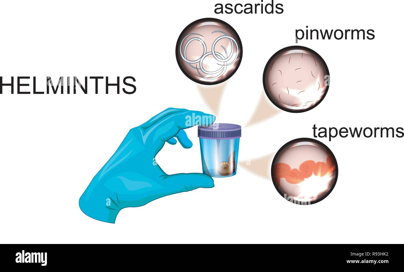 Vers intestinaux humain Banque de photographies et d’images à haute ...