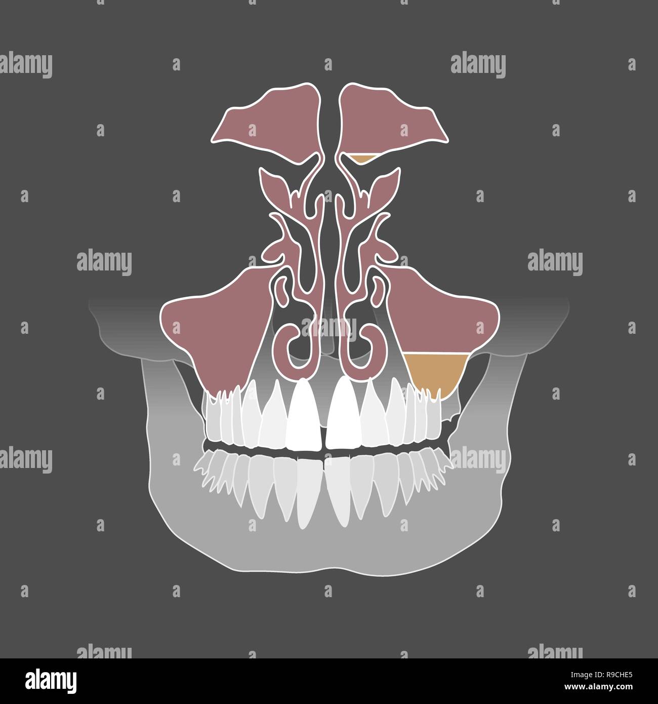 Frontal Sinus Cavity Banque d'image et photos - Alamy