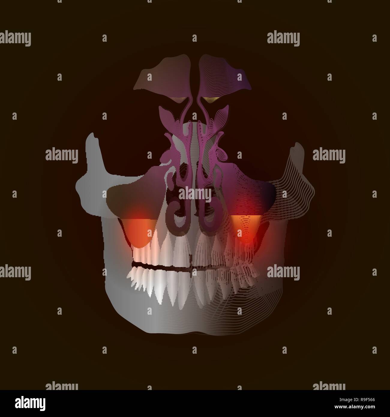 Sinus maxillaire radio Banque d'images vectorielles - Alamy