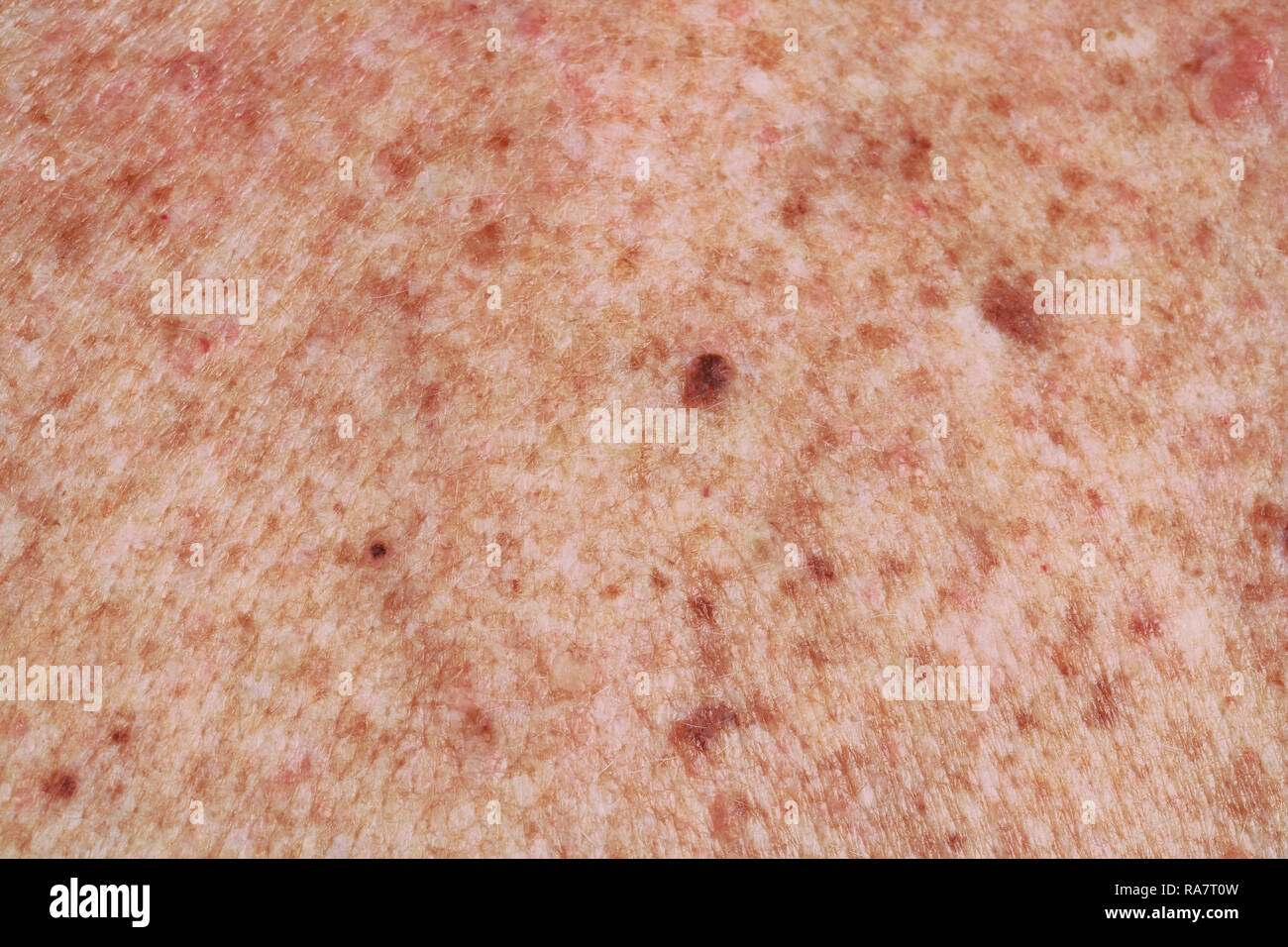 La surface de la peau des personnes âgées vieille femme. Beaucoup de ...