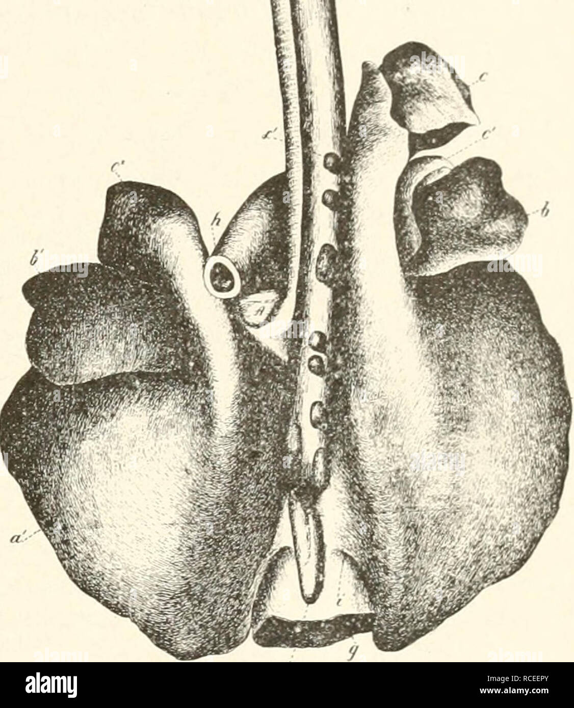 . La pathologie et le diagnostic différentiel des maladies infectieuses ...