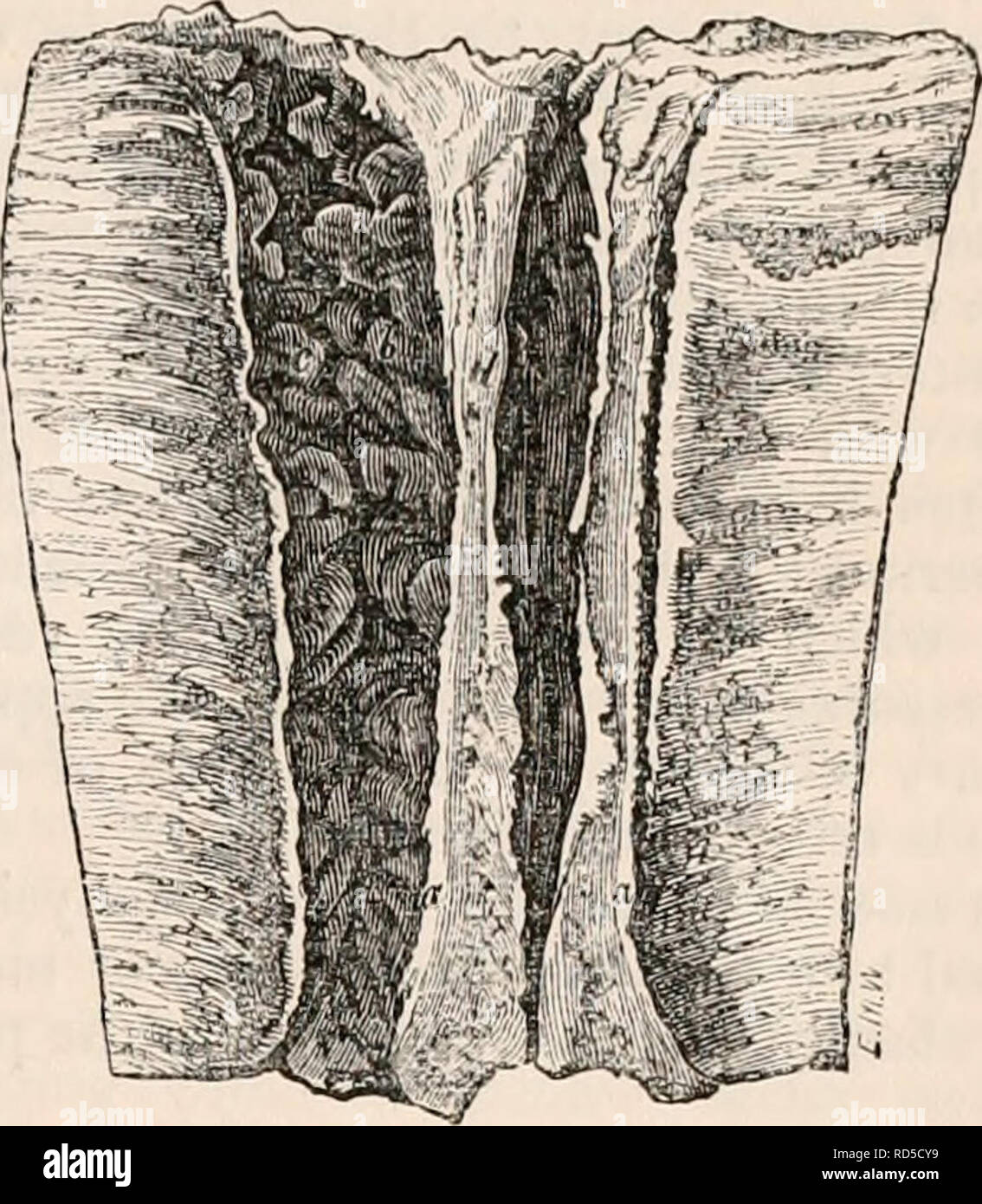 Muscle coccygeus Banque de photographies et d’images à haute résolution ...