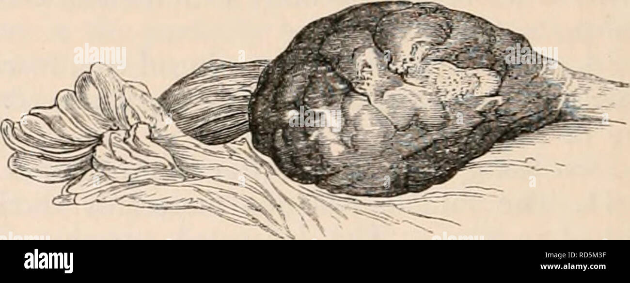 Colonne rénale Banque de photographies et d’images à haute résolution ...