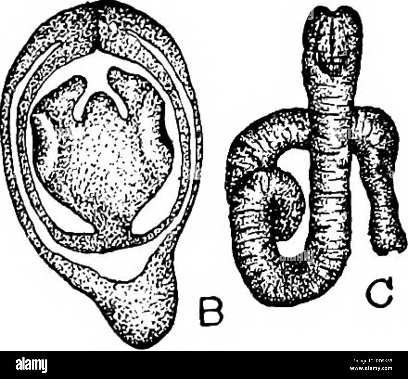 Larve De Cysticerque De Taenia Solium