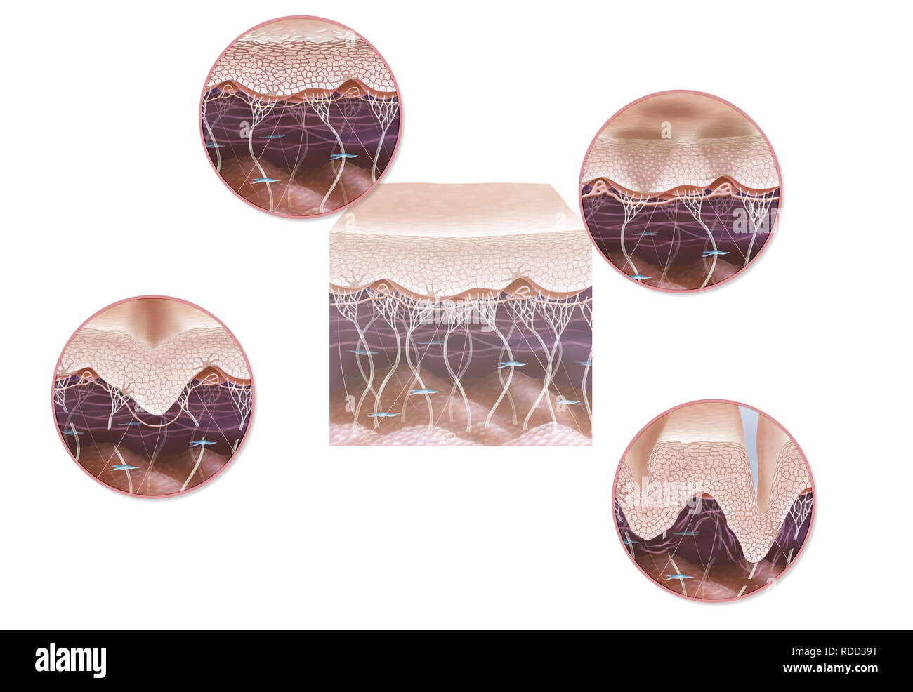 Taches brunes peau humaine Banque d'images détourées - Alamy