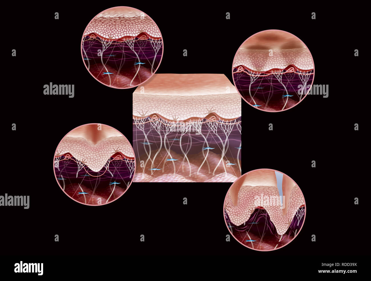 Taches brunes peau humaine Banque de photographies et d’images à haute ...