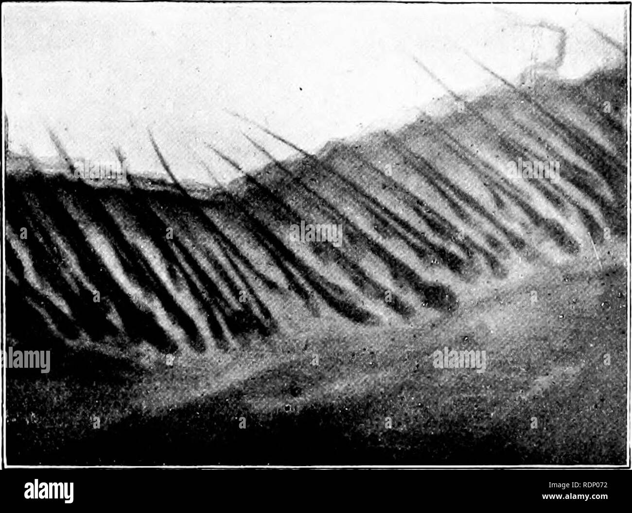 Human skin cells microscope Banque d'images noir et blanc - Alamy