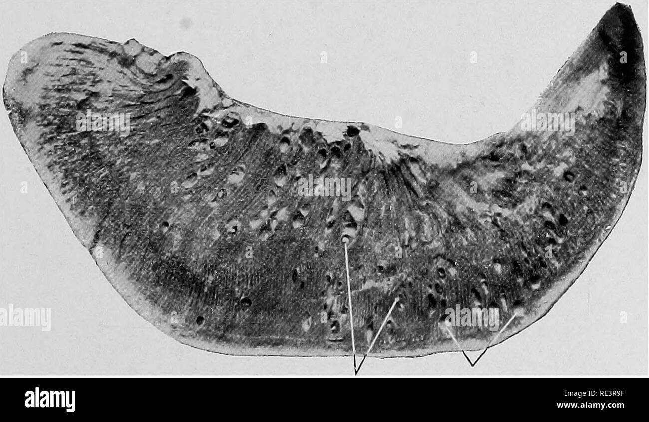 Maladie trichinose Banque de photographies et d’images à haute ...