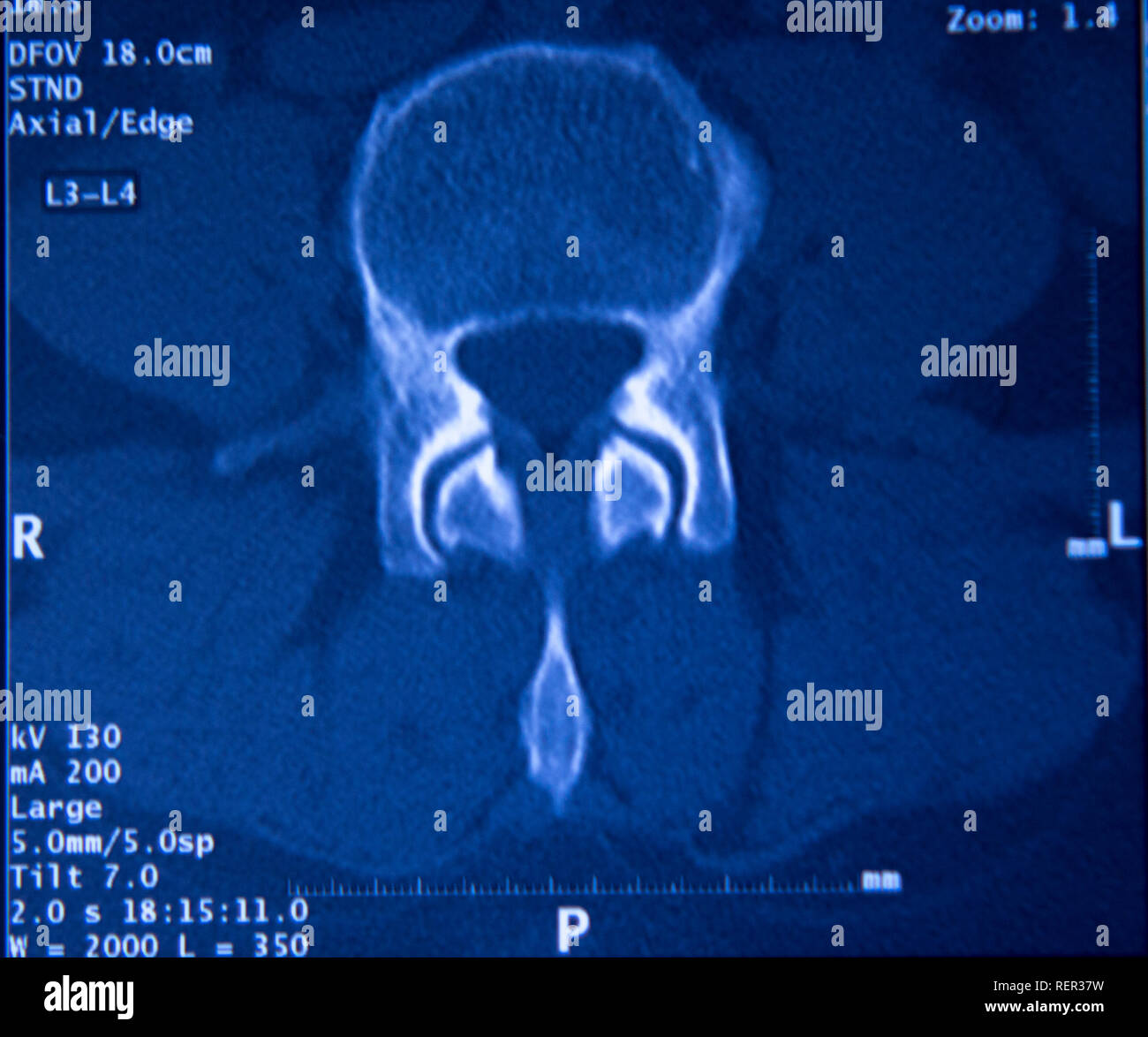 X-ray hôpital médical rachis bassin hanches traumatologie IRM scan ...