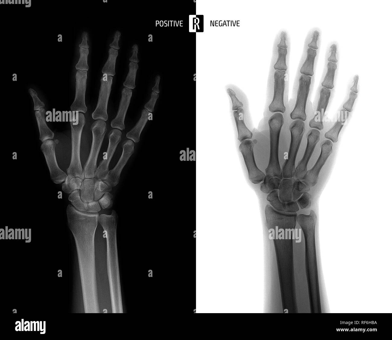 Anatomie normale du corps humain Banque d'images noir et blanc - Alamy