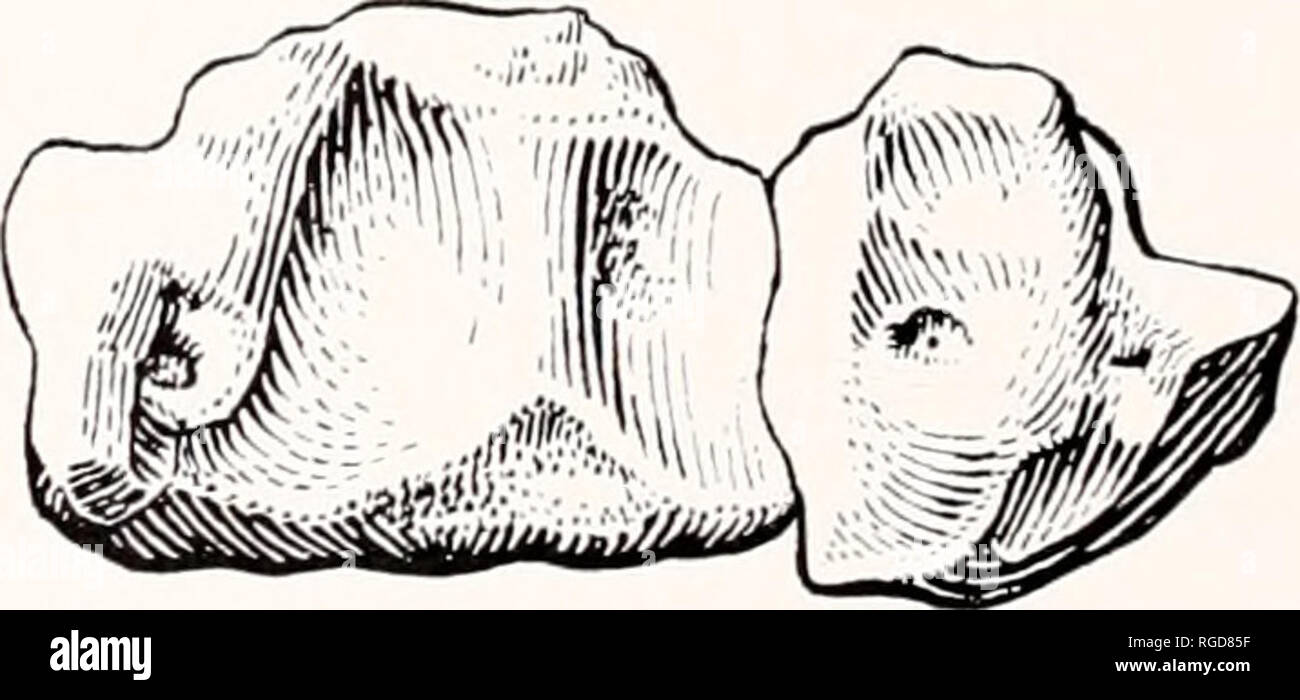 Péroné distal droit Banque de photographies et d’images à haute ...