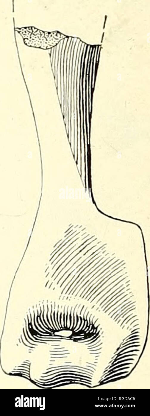 Scapula lateral Banque de photographies et d’images à haute résolution ...