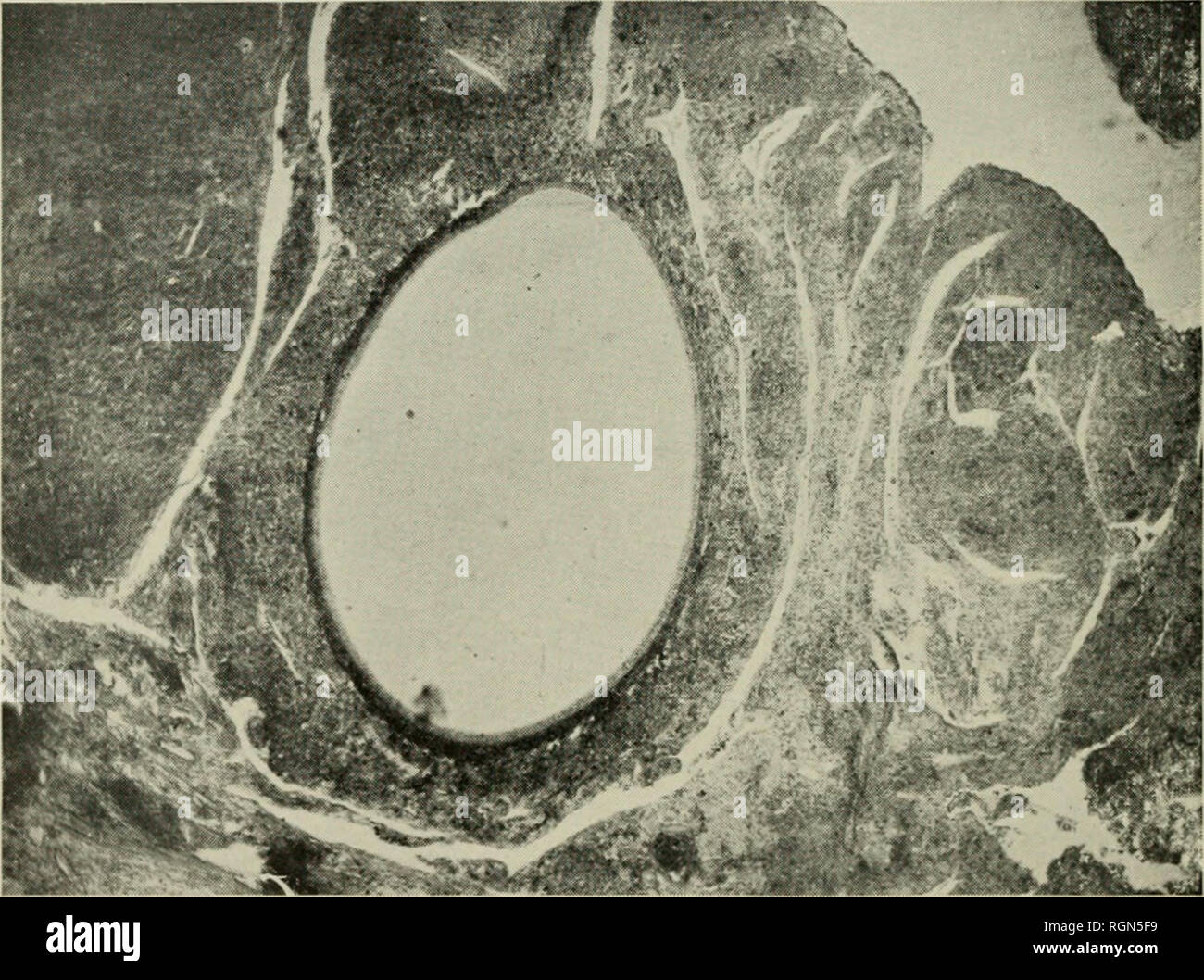 Plexus coeliaque Banque de photographies et d’images à haute résolution ...