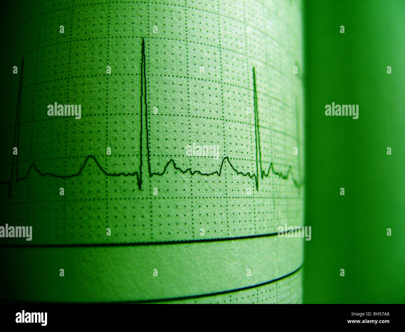 Electrocardiograma normal Banque de photographies et d’images à haute ...
