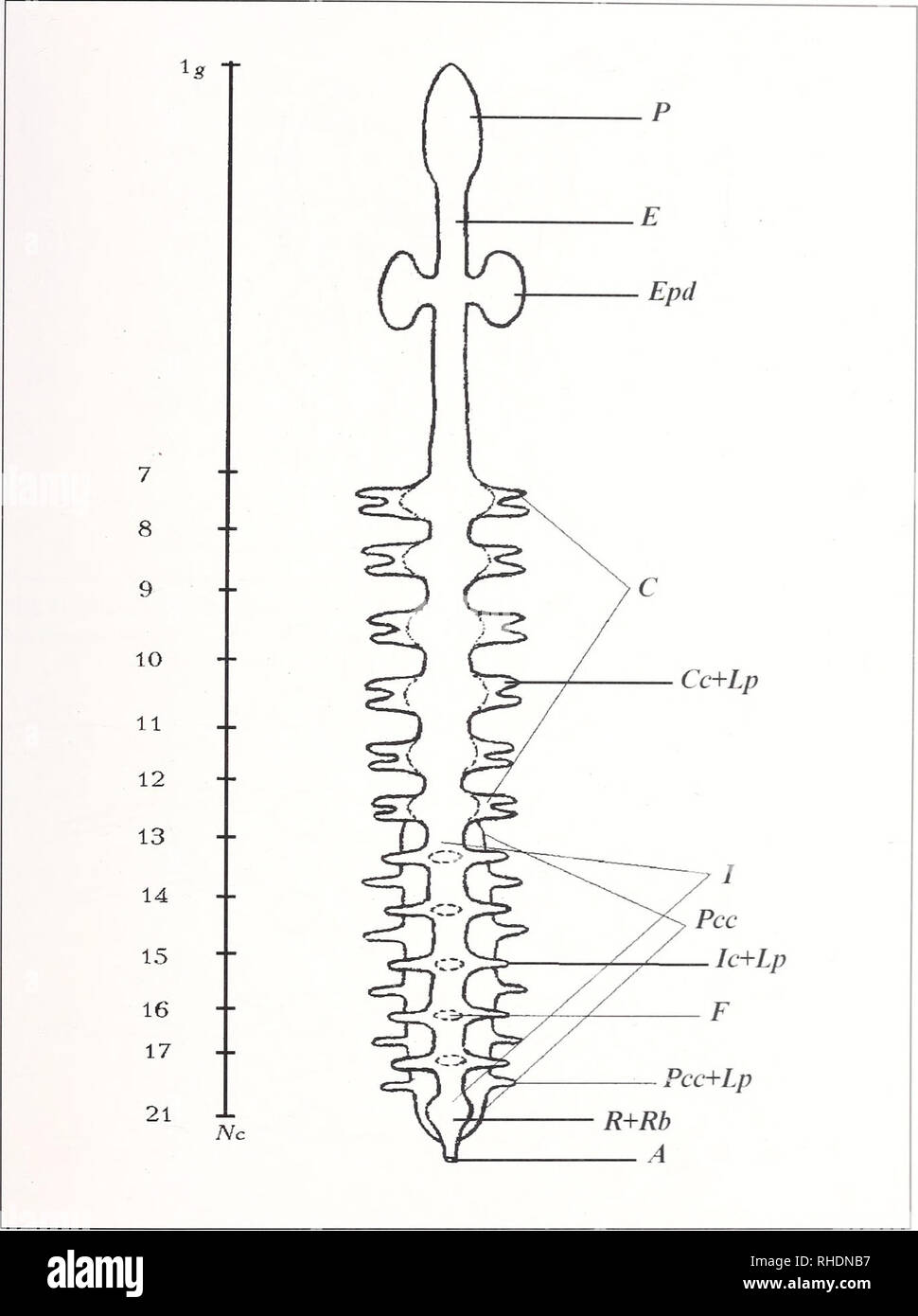 Diverticules intestinaux Banque de photographies et d’images à haute ...