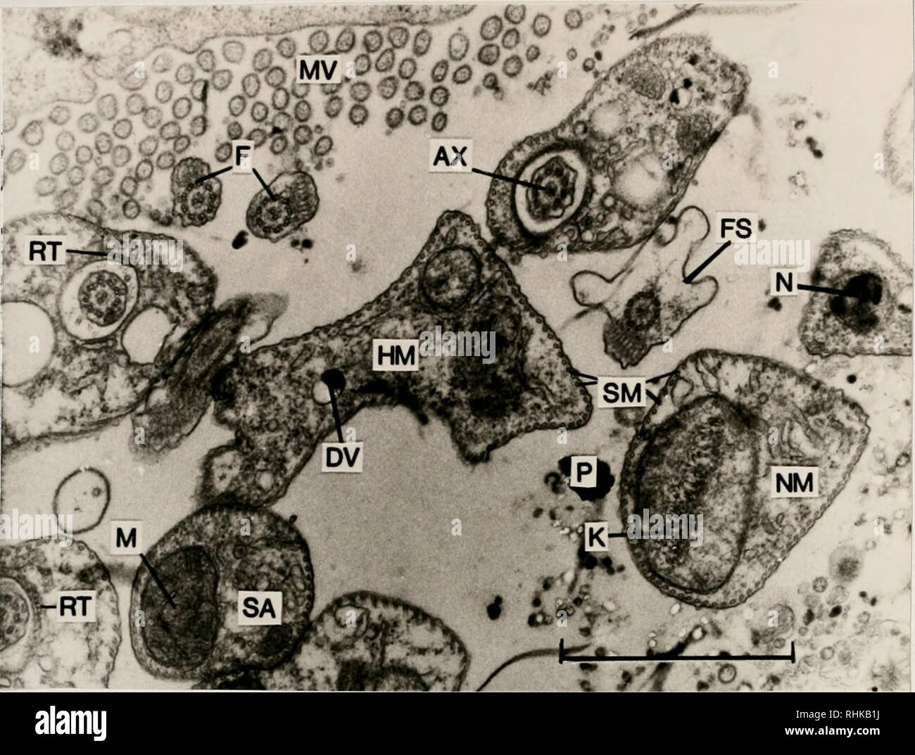 Leishmaniose cutanée Banque de photographies et d’images à haute ...